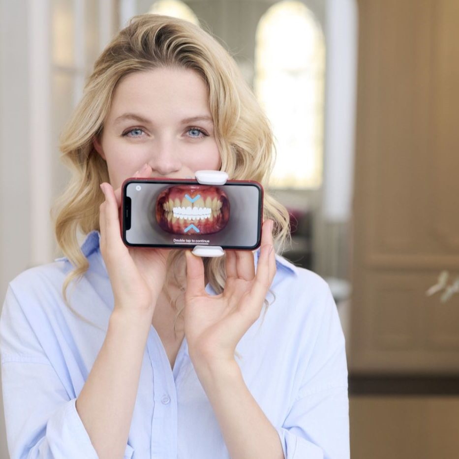 7 výhod dentálneho monitorovania pre pacientov s neviditeľnými aparátmi ...